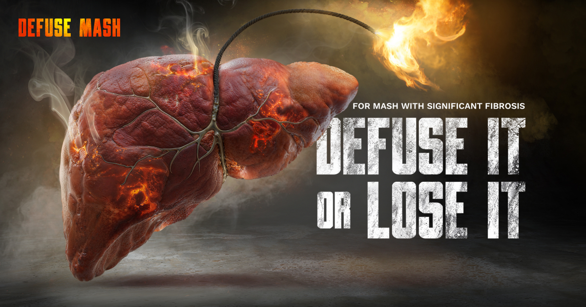 Defuse it or Lose it | Defuse MASH